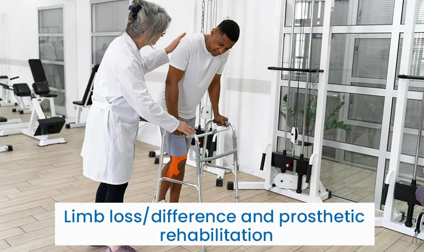 Difference in Limb Loss and Prosthetic Rehabilitation Guide